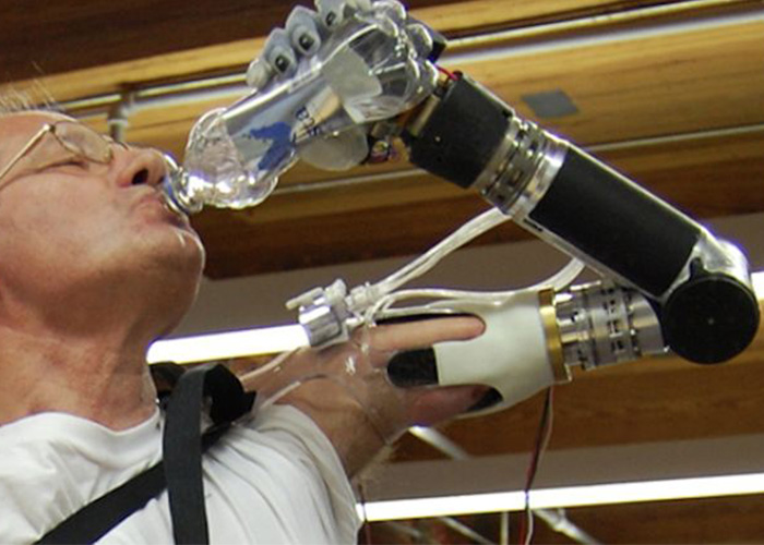 SoldierStrong & Mobius Bionics To Provide The Luke Arm To Veterans ...